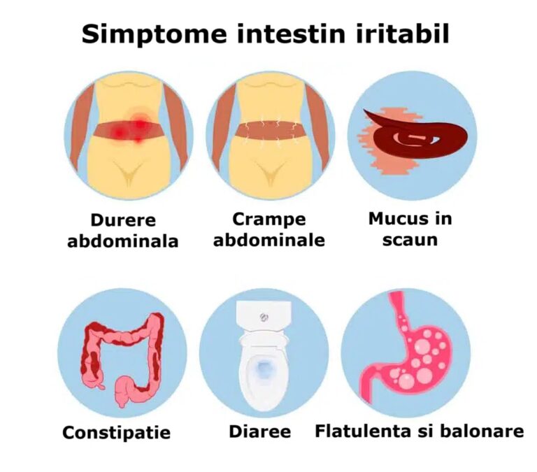 Cele mai bune probiotice pentru colon iritabil